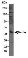 Anti-BECN1 / Beclin-1 Antibody (aa1-100, DY650) MX-C142265